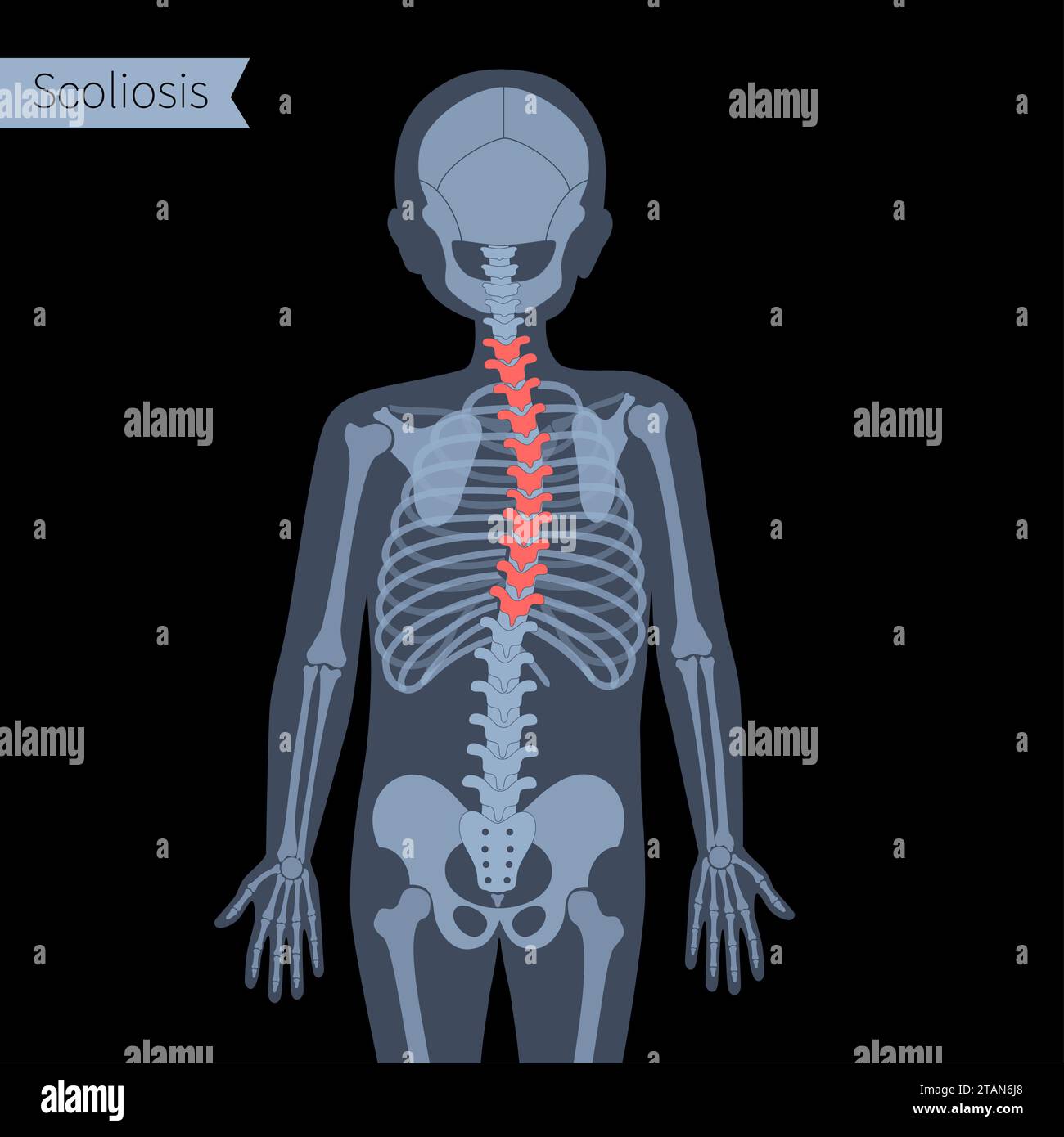 Human spine curve hi-res stock photography and images - Alamy