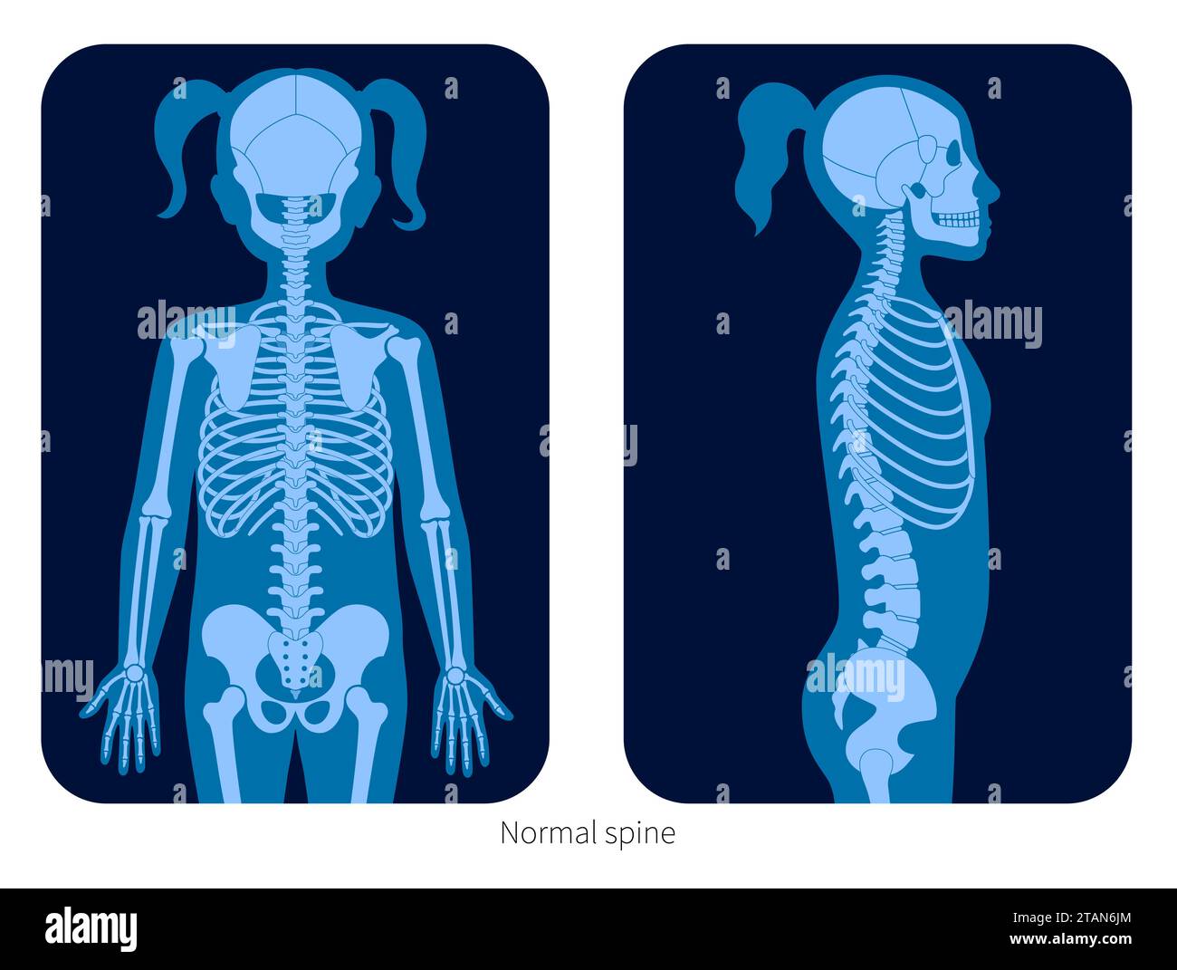Healthy spine, illustration Stock Photo - Alamy