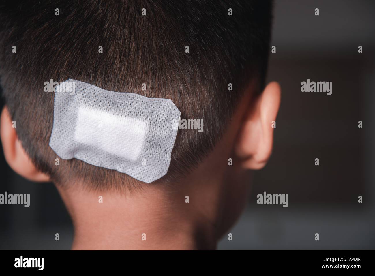 Back of head scar hi-res stock photography and images - Alamy