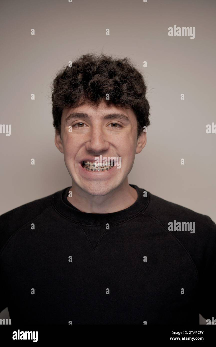 Lifestyle orthodontics hi-res stock photography and images - Alamy