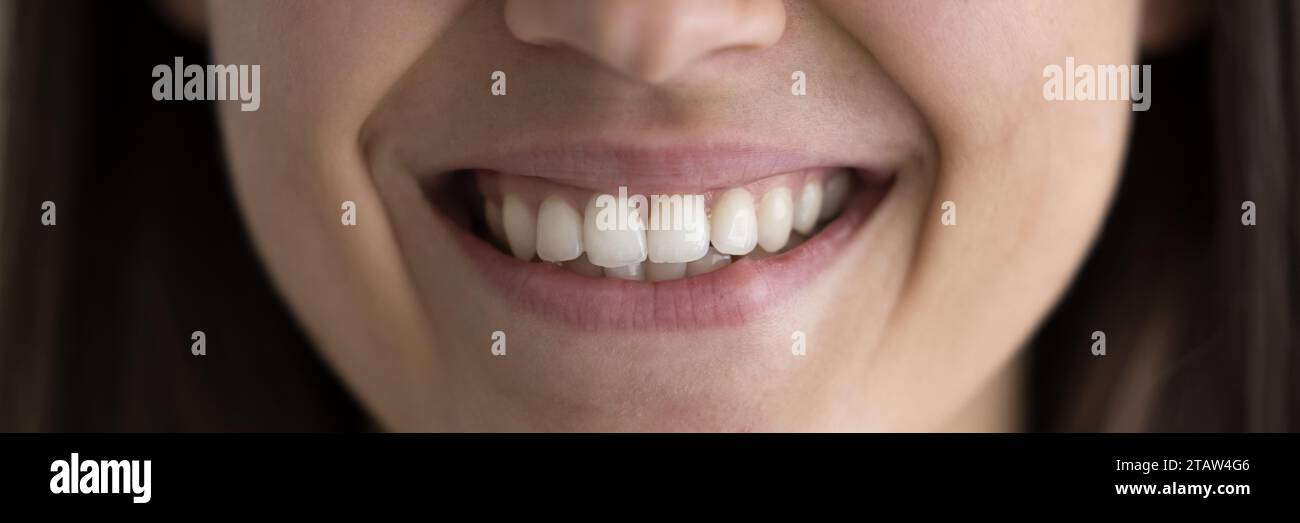 Closeup cropped lower face view woman having wide toothy smile Stock ...