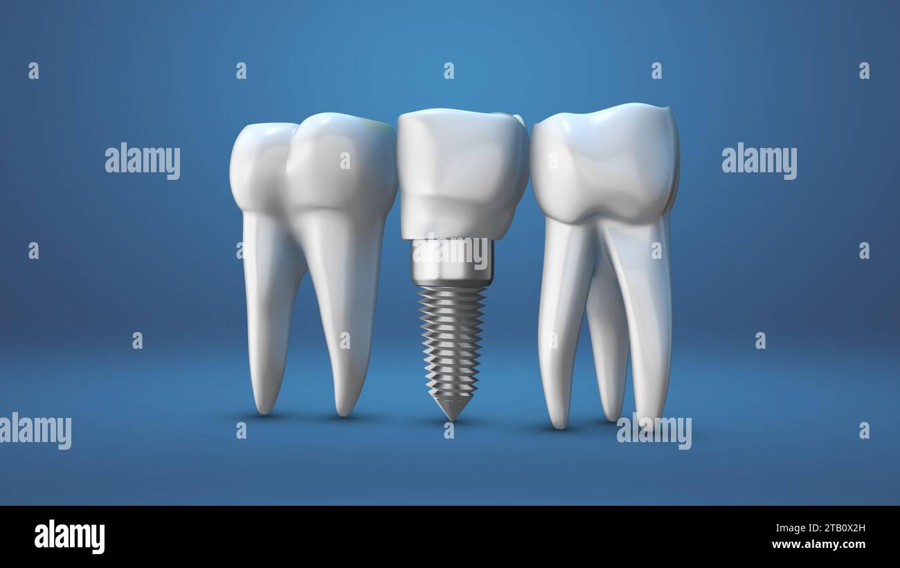 Animation of the human teeth and dentures Stock Photo - Alamy