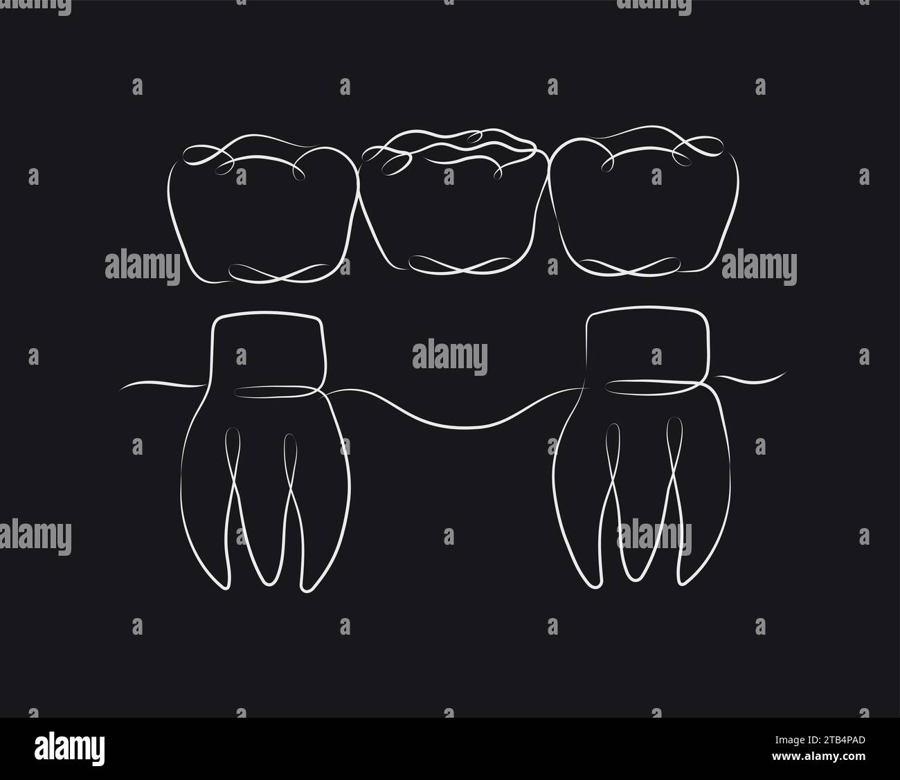 Teeth with crown bridge illustration drawing in linear style on black ...