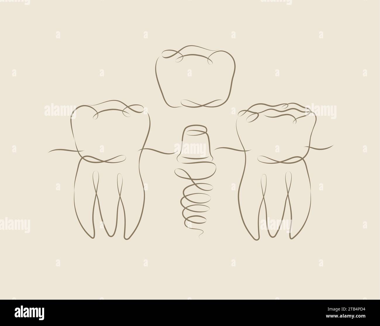 Teeth implant illustration drawing in linear style on beige background ...