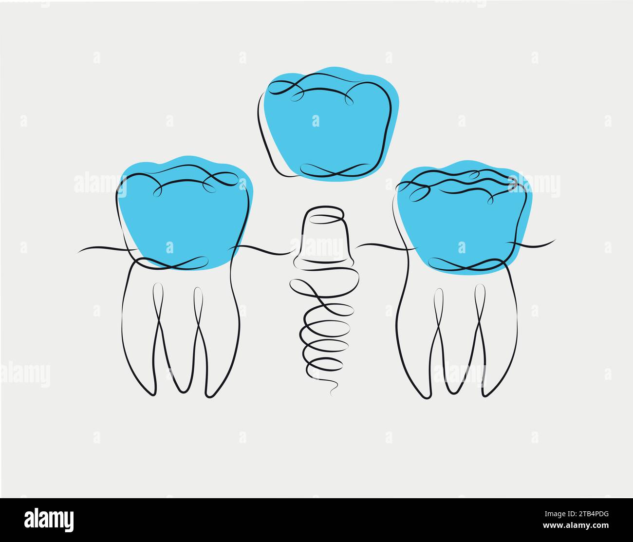 Teeth implant illustration drawing in linear style on white and blue ...