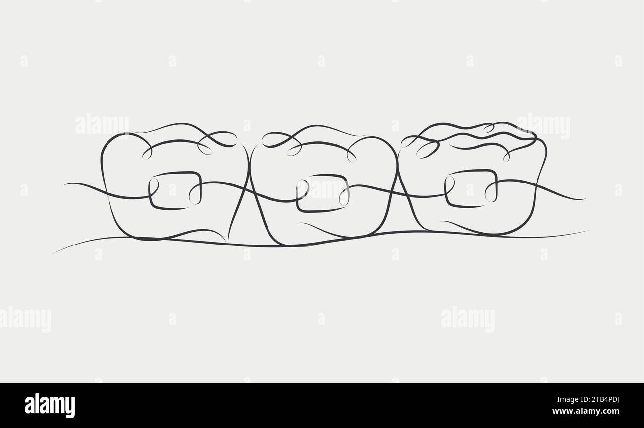 Teeth braces illustration drawing in linear style on white color ...