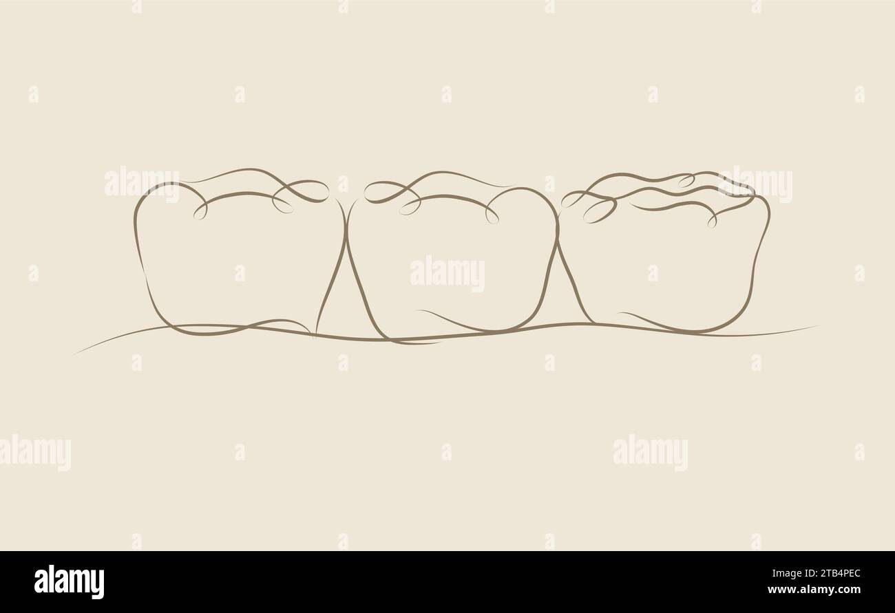 Implanted teeth with crown bridge illustration drawing in linear style ...