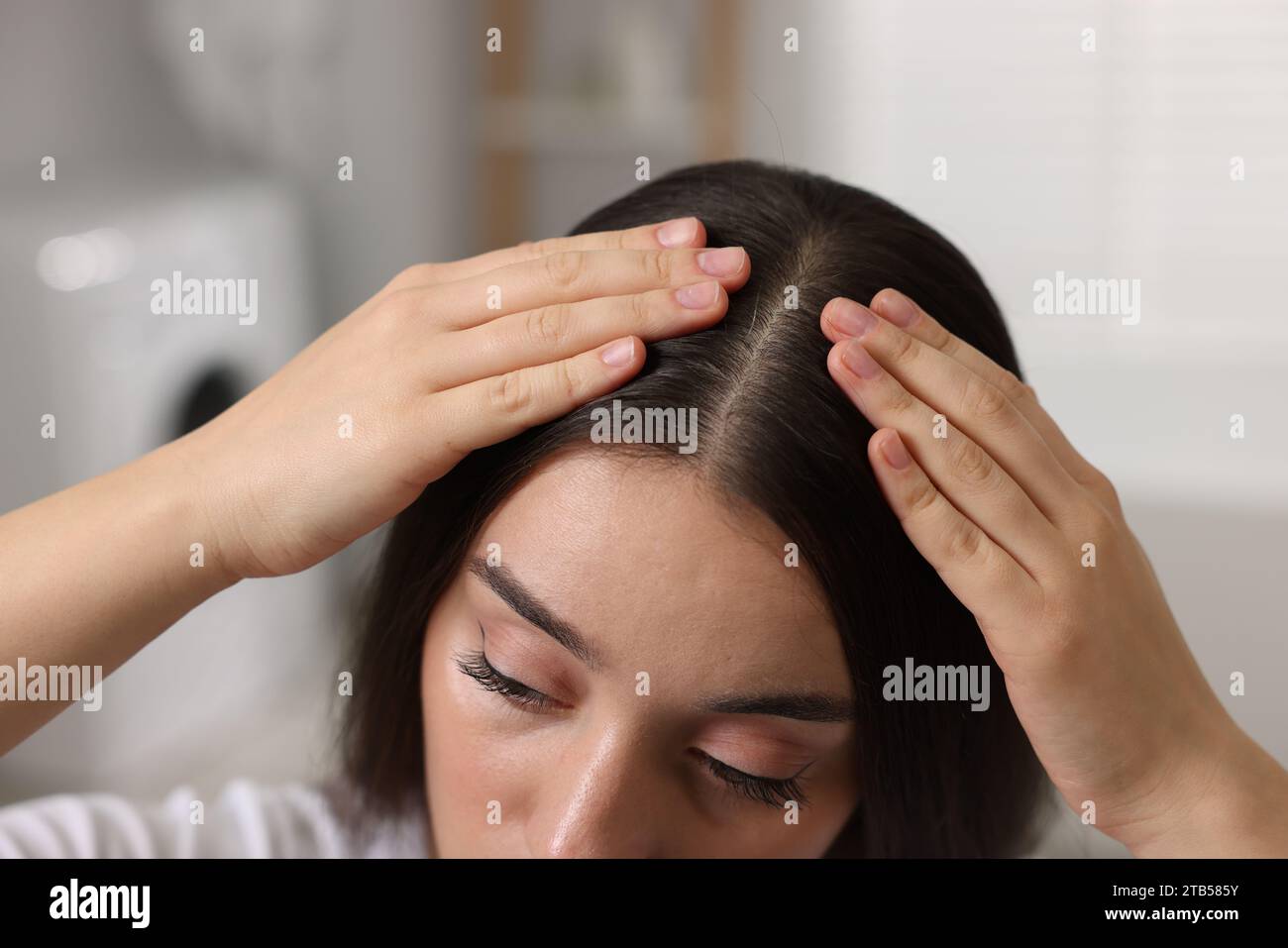 Scalp disease woman hi-res stock photography and images - Alamy