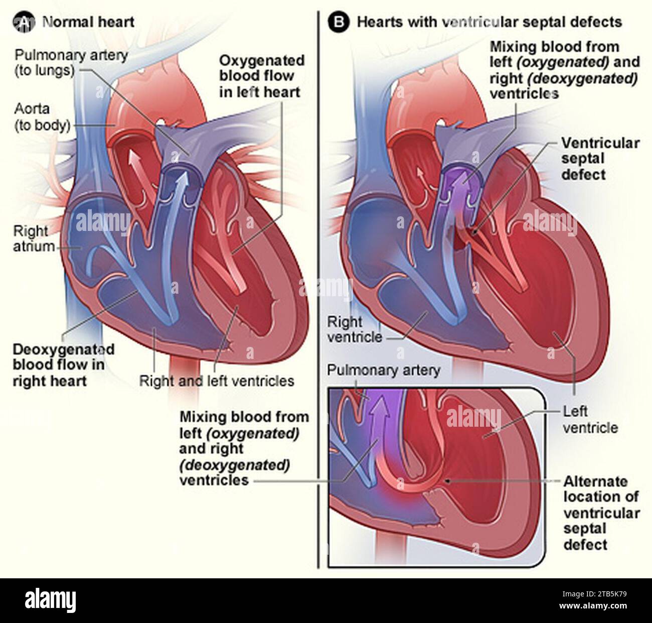 Vsd hi-res stock photography and images - Alamy