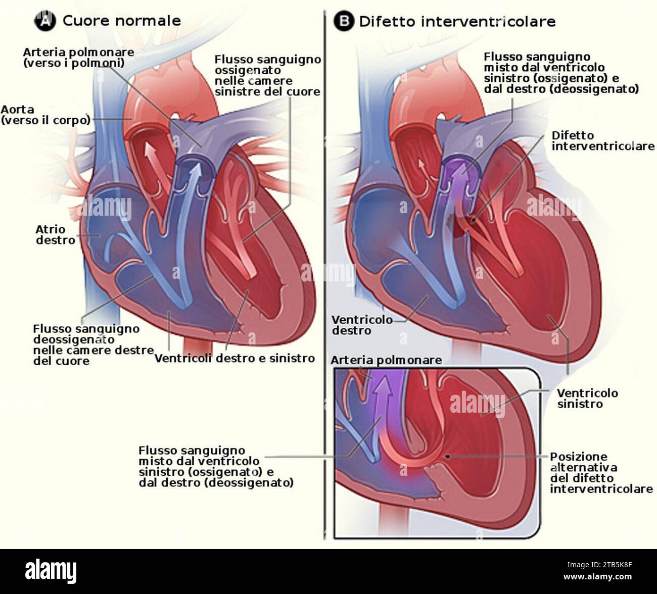 Vsd hi-res stock photography and images - Alamy