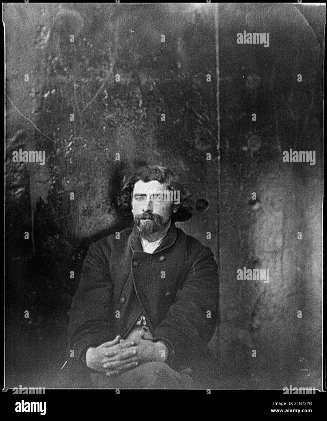 Who had a bald forehead Black and White Stock Photos & Images - Alamy