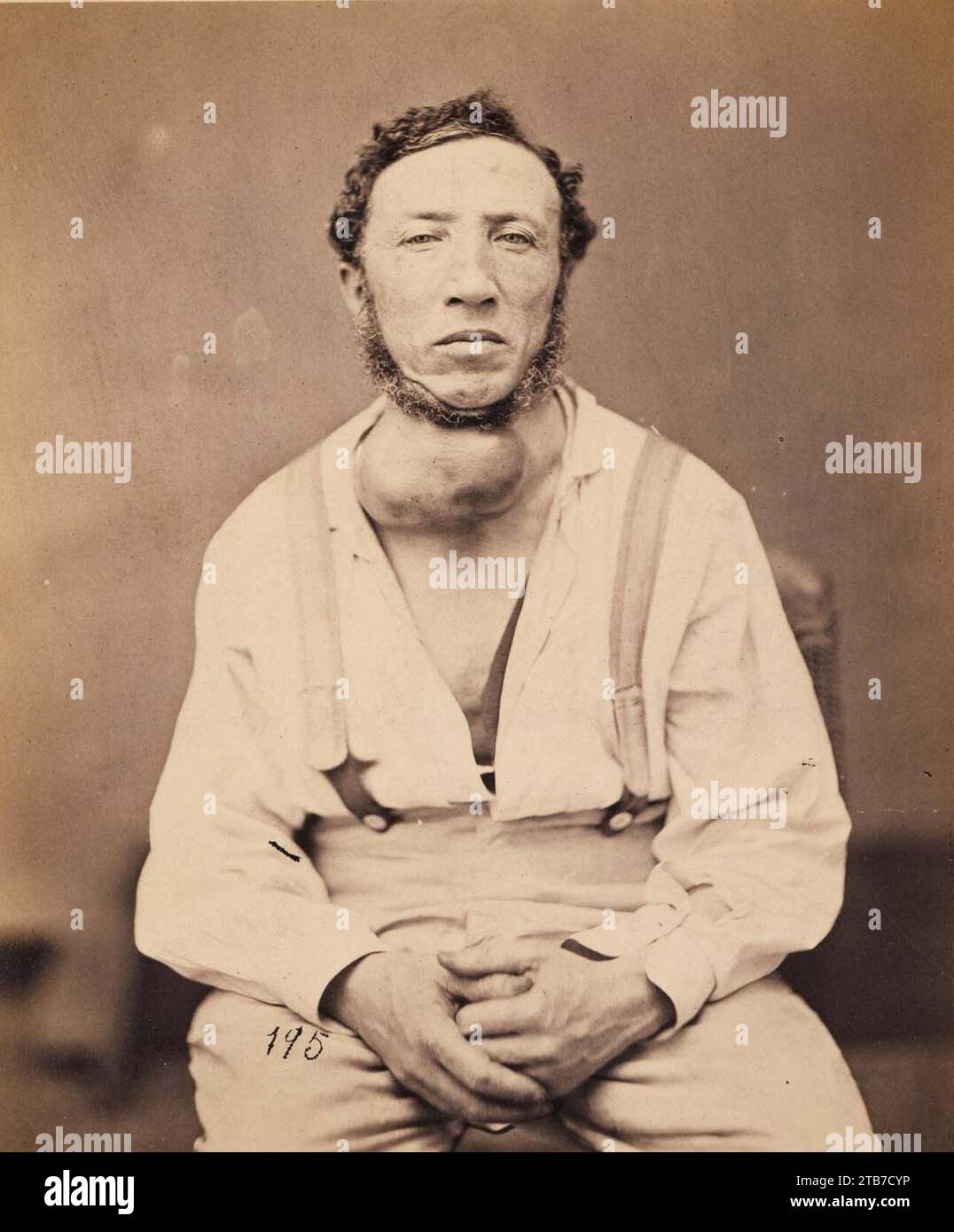 Innominate artery hi-res stock photography and images - Alamy