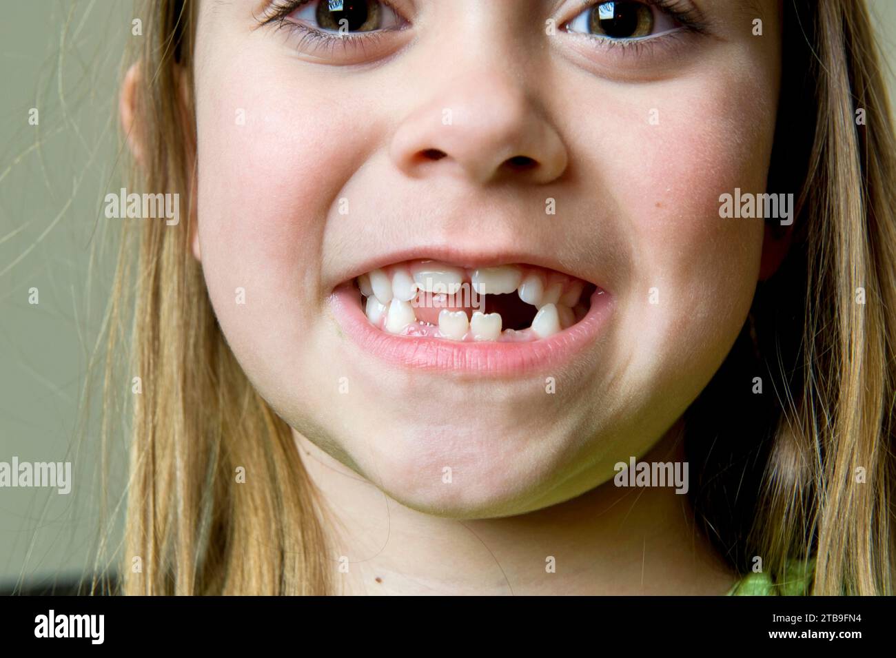 Portrait of a young girl showing her teeth; Lincoln, Nebraska, United ...
