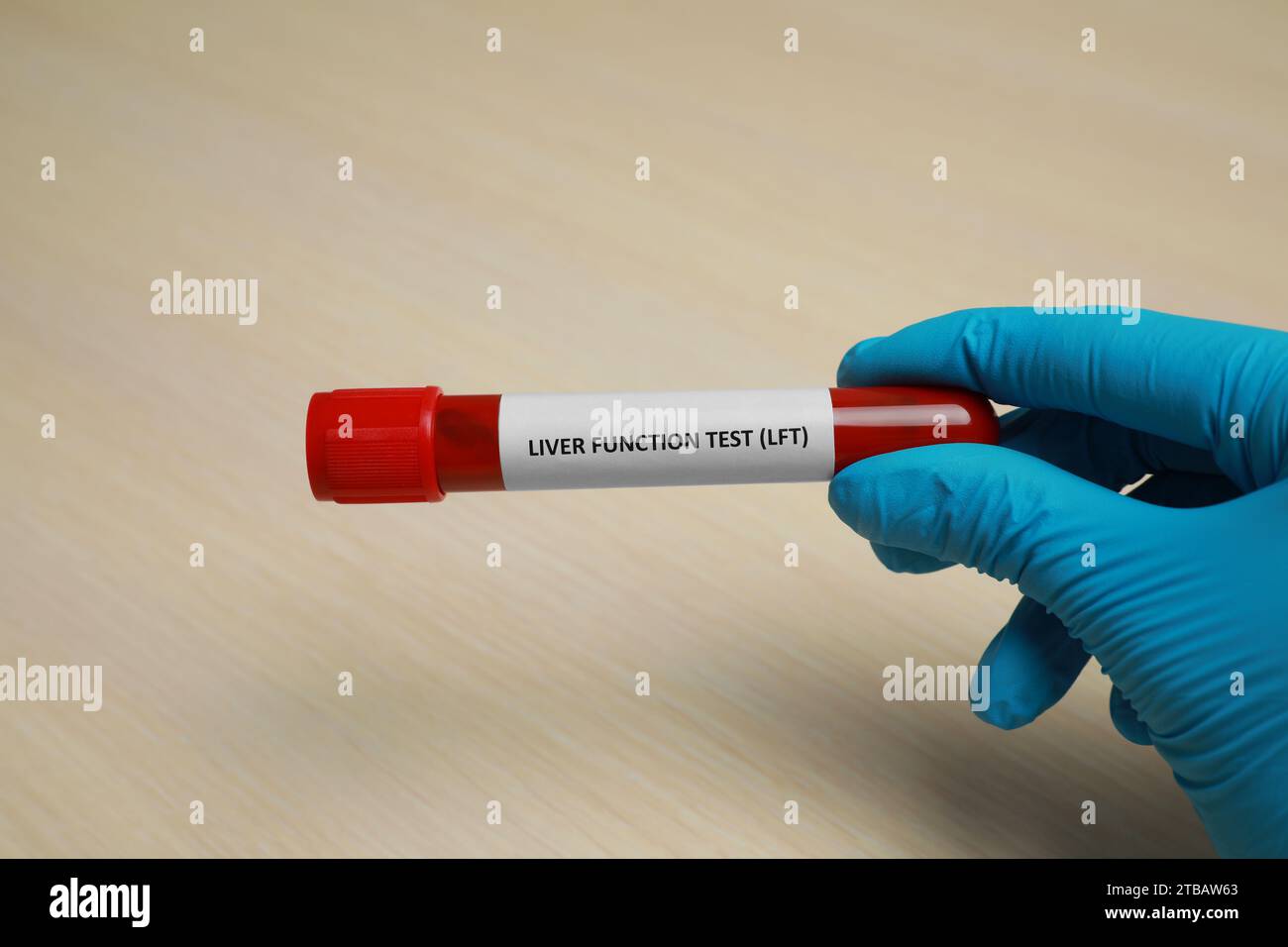 Laboratory worker holding tube with blood sample and label Liver ...