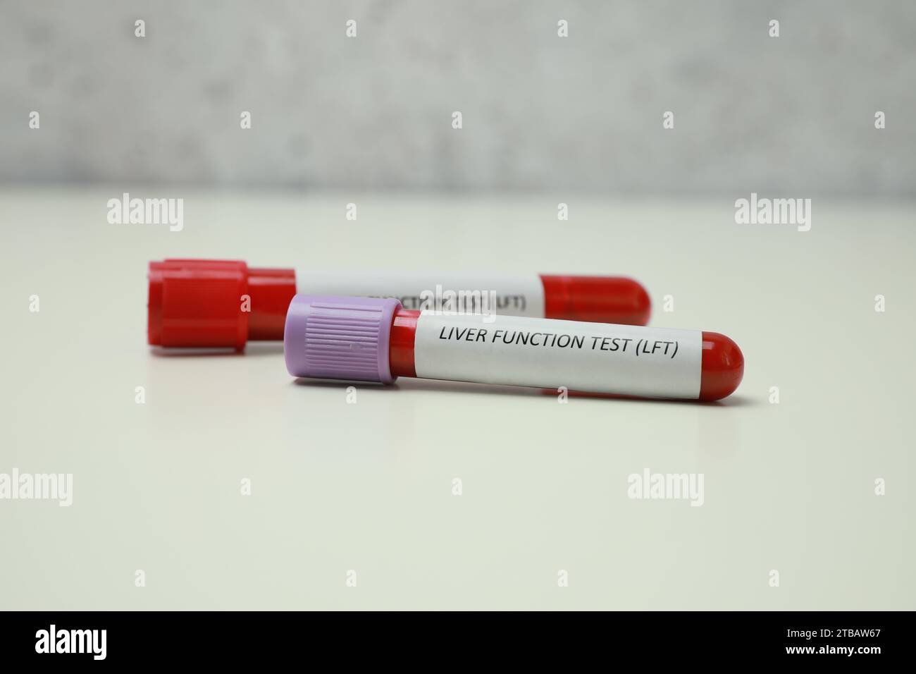 Liver Function Test. Tubes with blood samples on white table Stock ...
