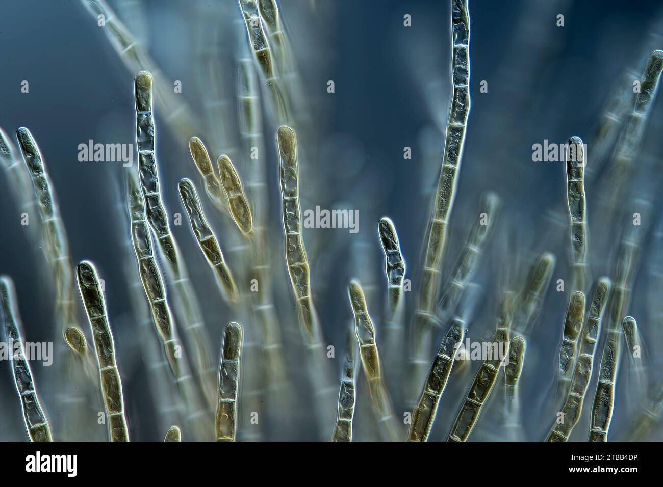 Audouinella algae, light micrograph Stock Photo - Alamy