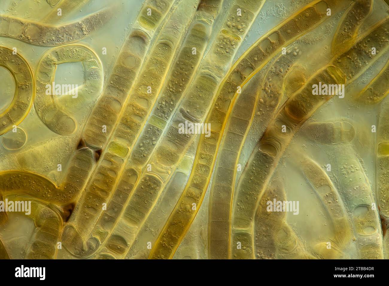 Scytonema algae, light micrograph Stock Photo - Alamy