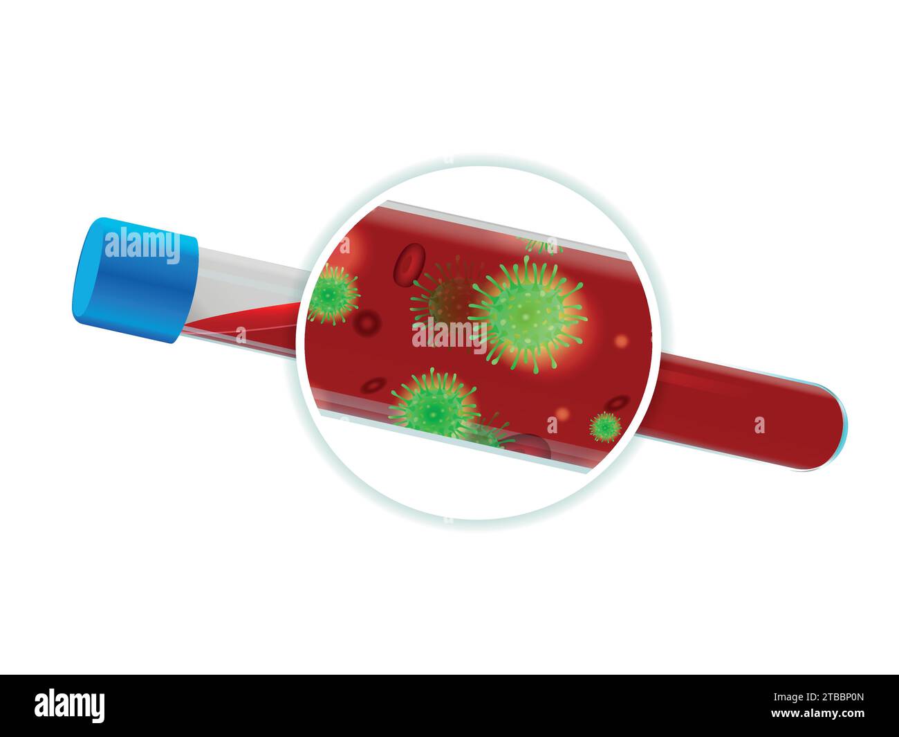Test tube with blood for analysis. Positive result for the presence of ...
