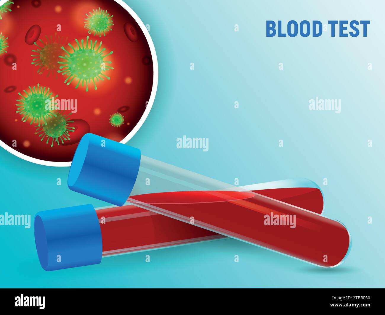 Test tubes with blood for analysis. Positive result for the presence of ...