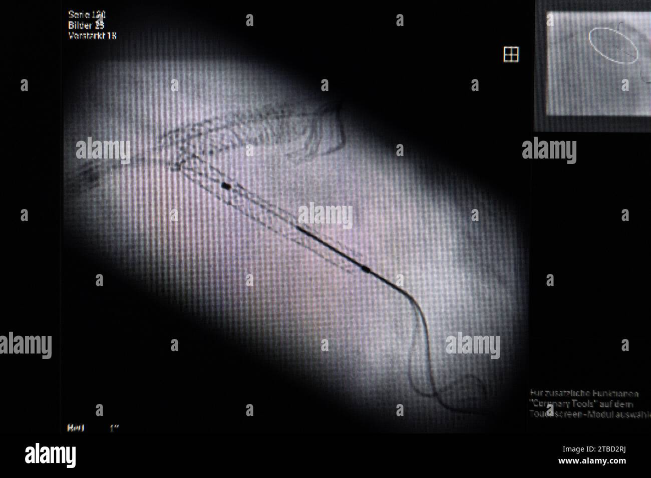 Pci x image hi-res stock photography and images - Alamy