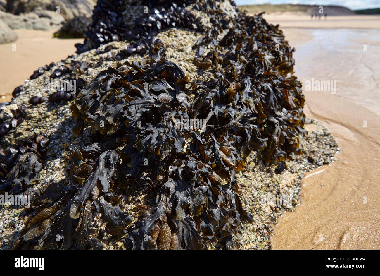 Bladder stone hi-res stock photography and images - Alamy