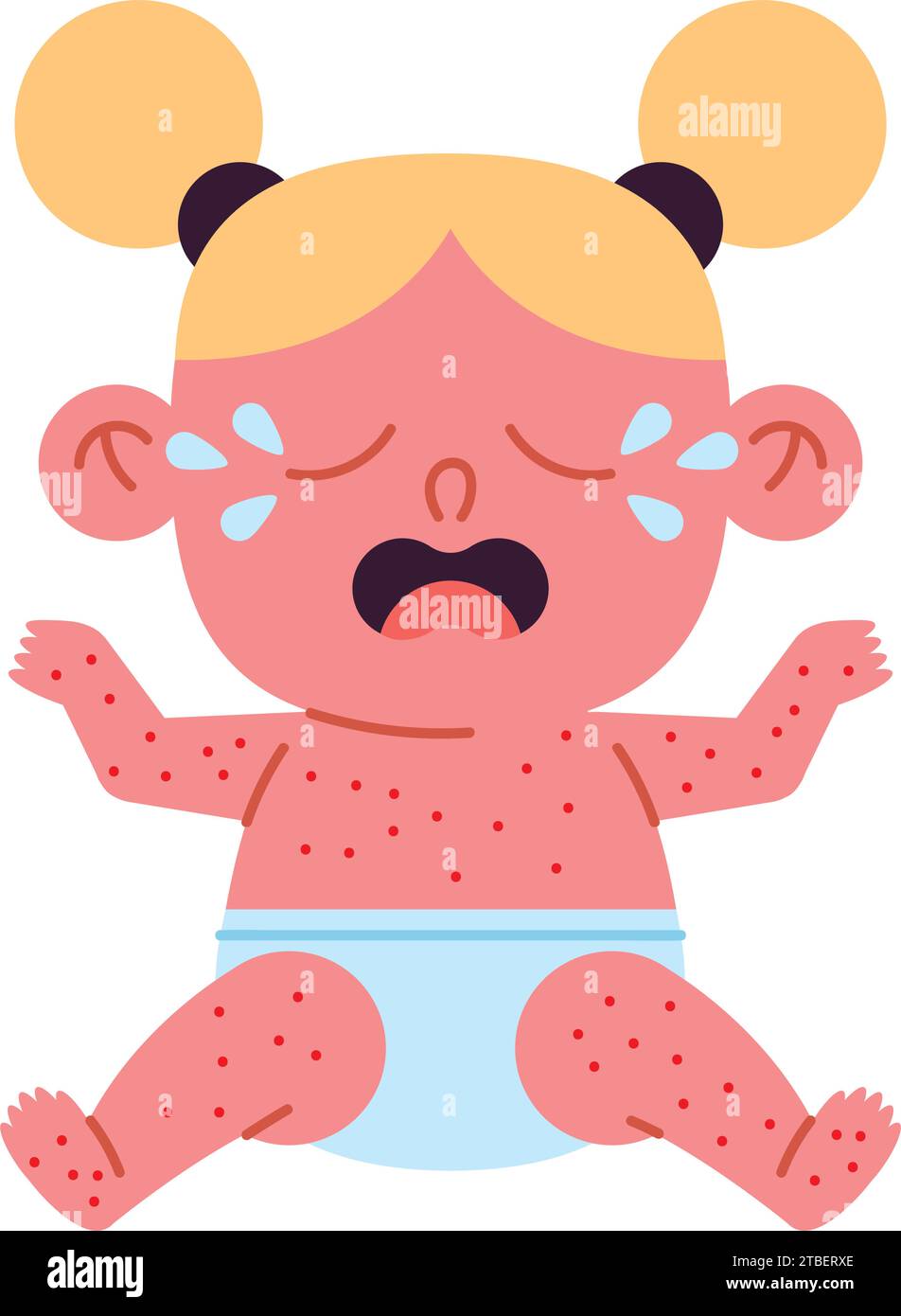 kawasaki disease on a girl baby vector isolated Stock Vector Image ...