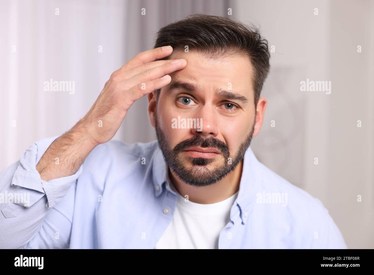 Skin problem. Confused man touching his face indoors Stock Photo - Alamy