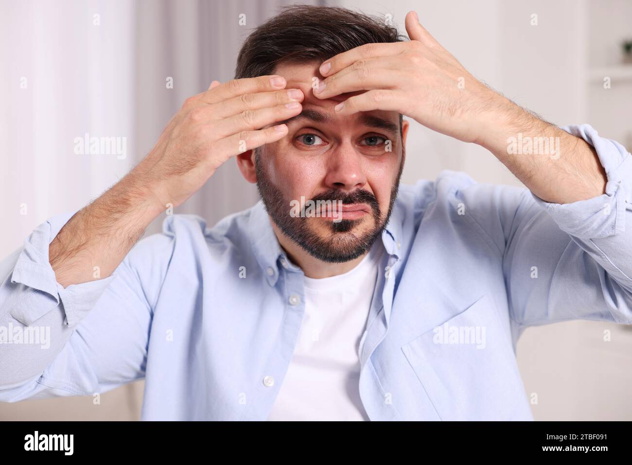 Skin problem. Confused man touching his face at home Stock Photo - Alamy