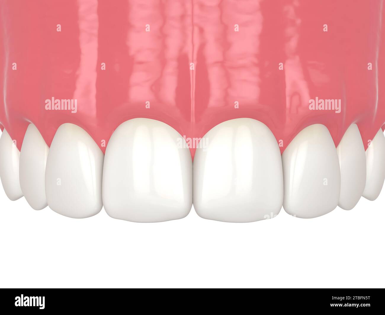 3d render of diastema closure using bonding procedure. Part 9 - Final ...