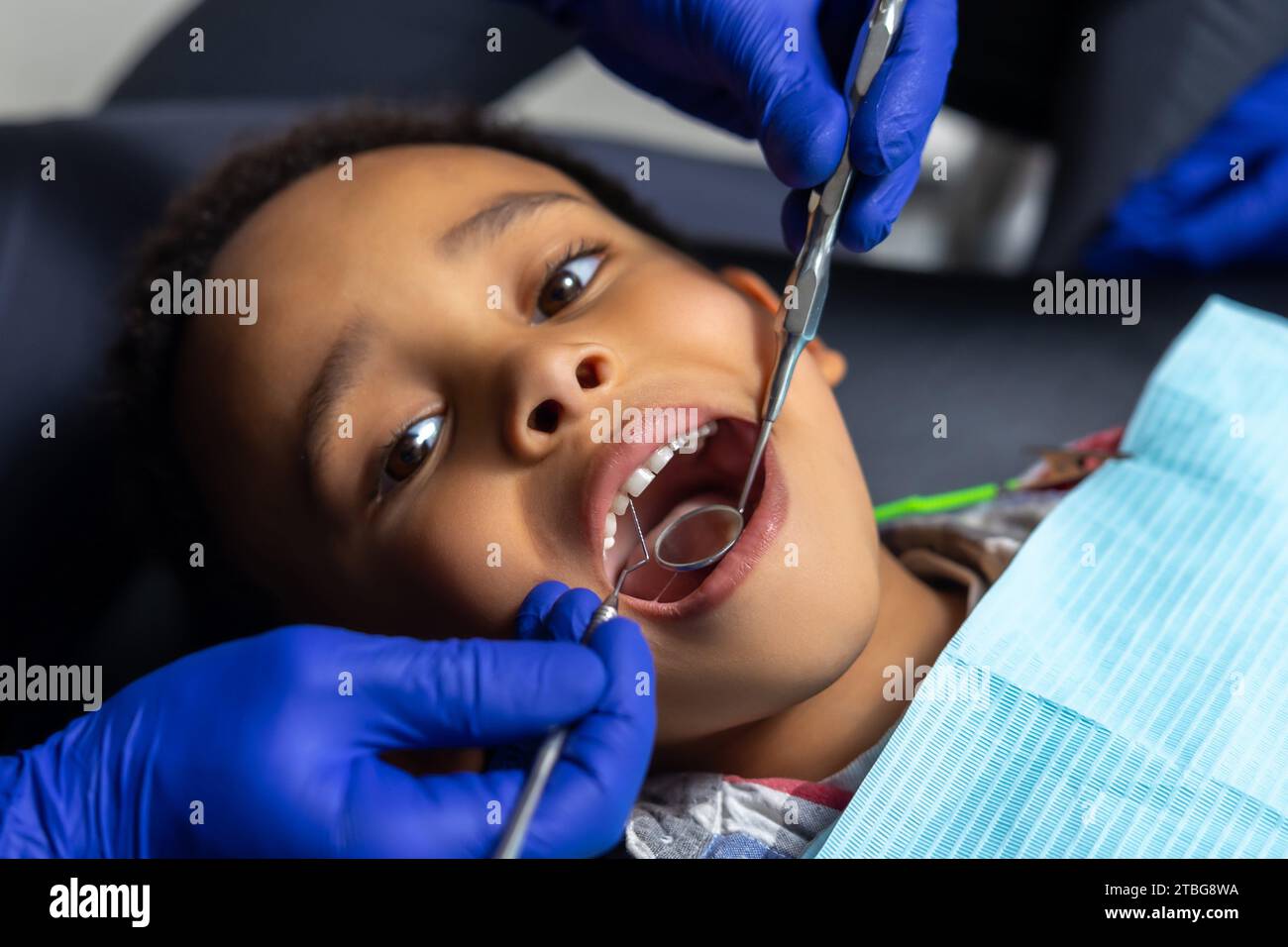 In dentistry. Dentist treating dark-skinned boys teeth Stock Photo - Alamy