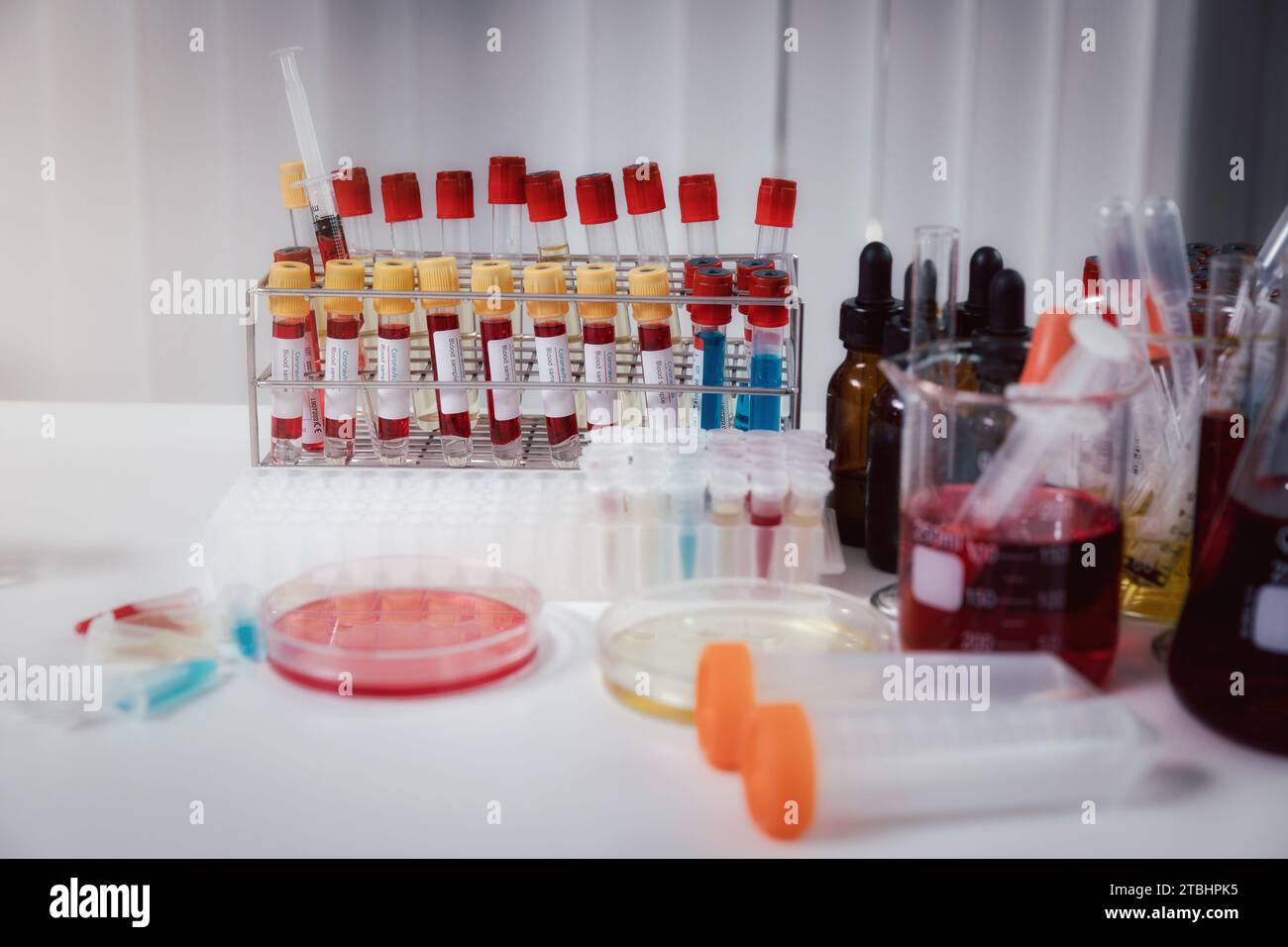 Blood samples in a test tube rack hi-res stock photography and images ...