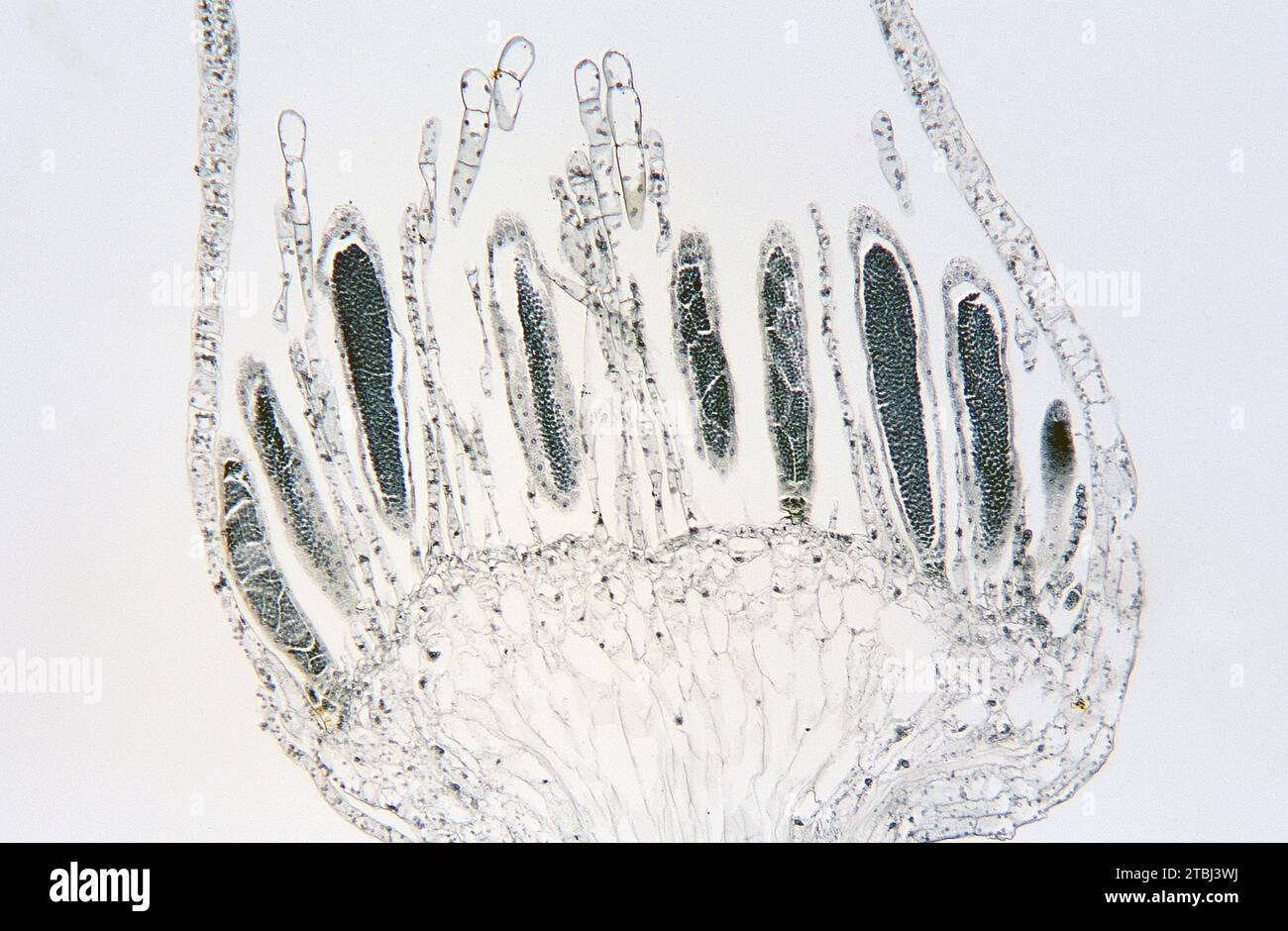 Moss antheridia micrograph. Antheridium contain male gametophytes ...