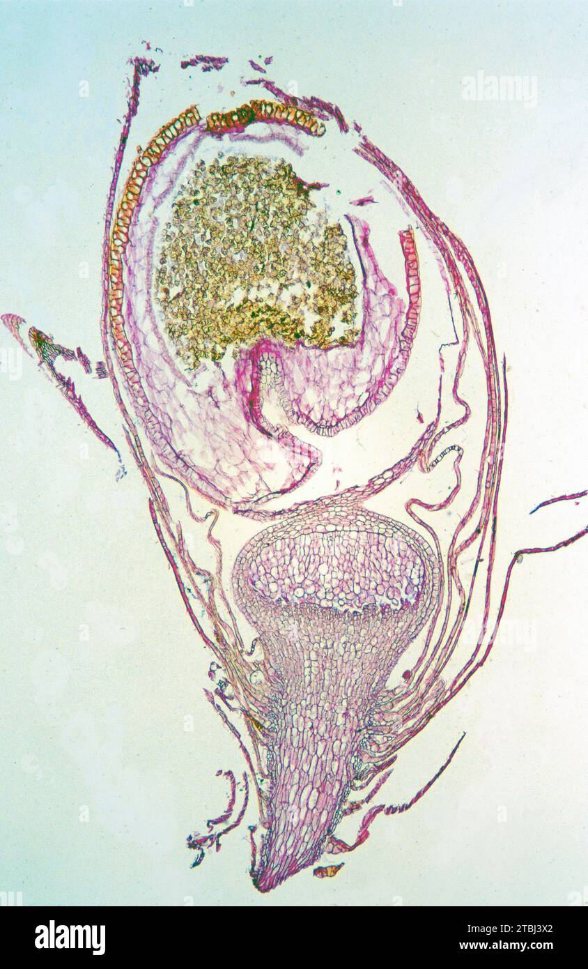 Moss capsule with spores (Sphagnum sp.). Optical microscope ...