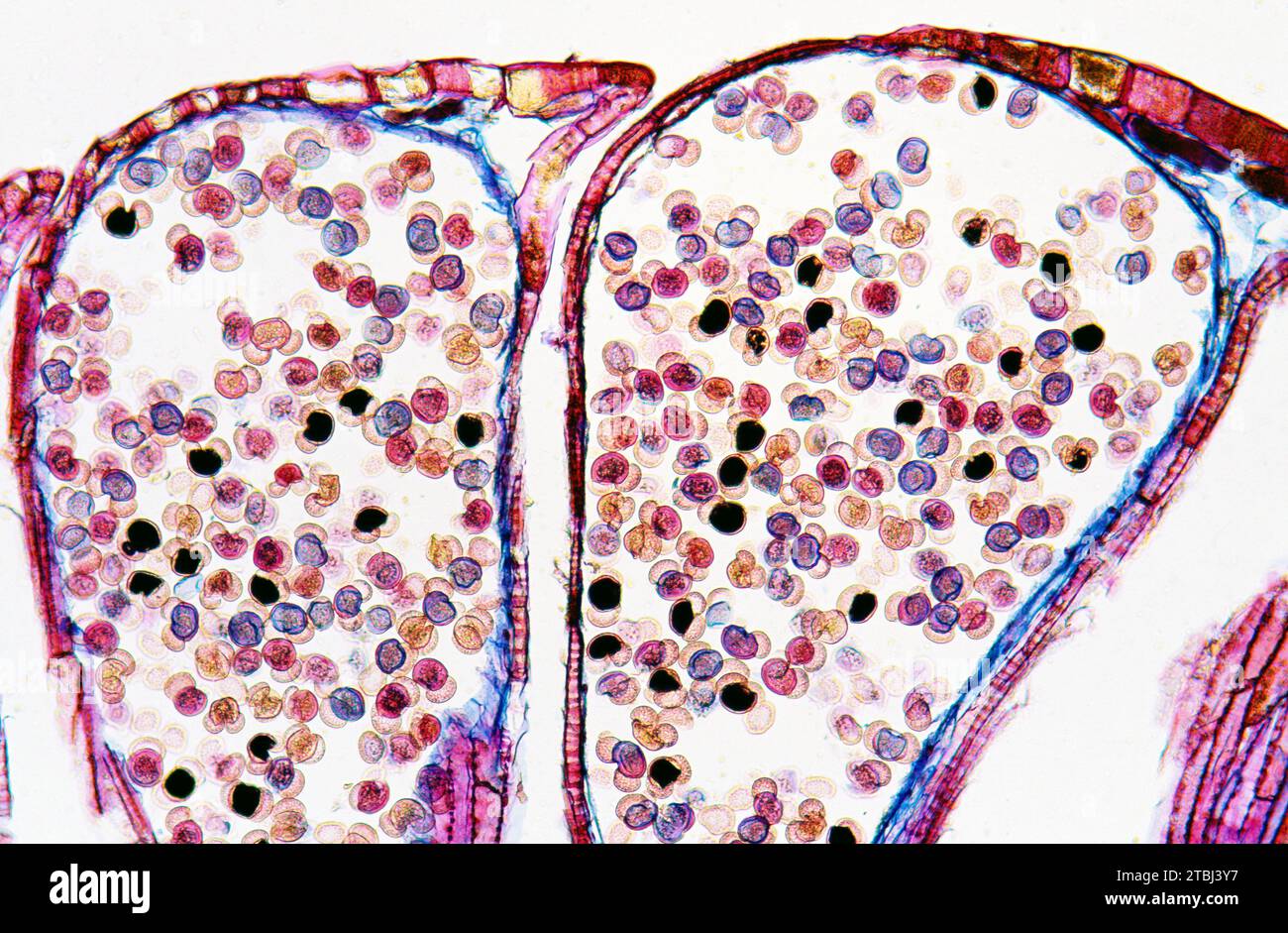 Male pine cone or strobilus showing the pollen. Optical microscope ...
