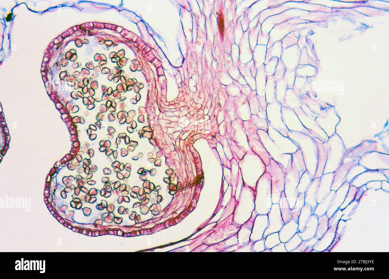 Lycopodium sporangium, longitudinal section. Optical microscope ...