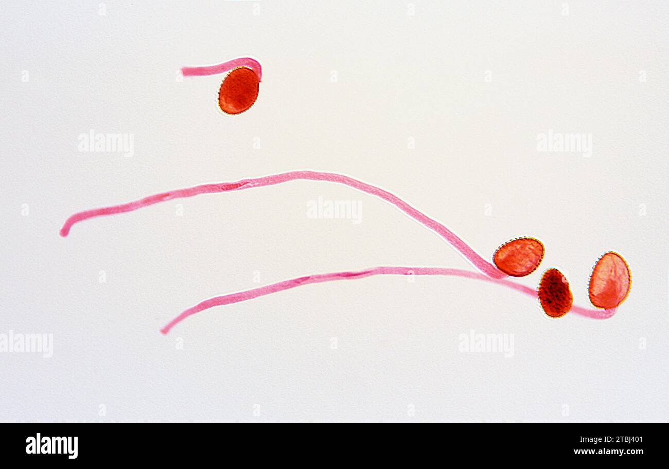 Pollen grains with pollen tube. Optical microscope. Magnification X200 ...