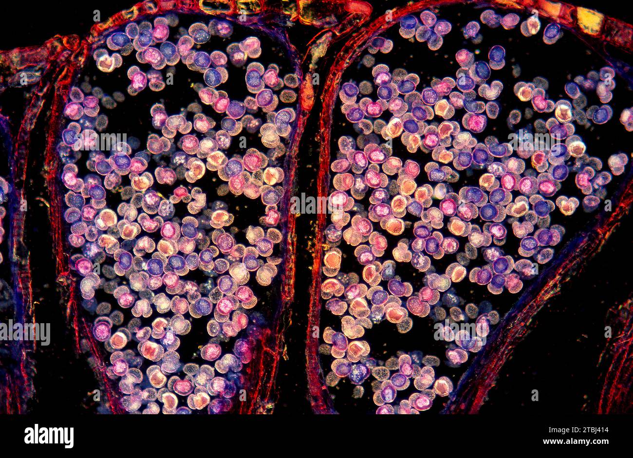 Male Cone Pinus Sp Showing Pollen Photomicrograph X100 Darkfield