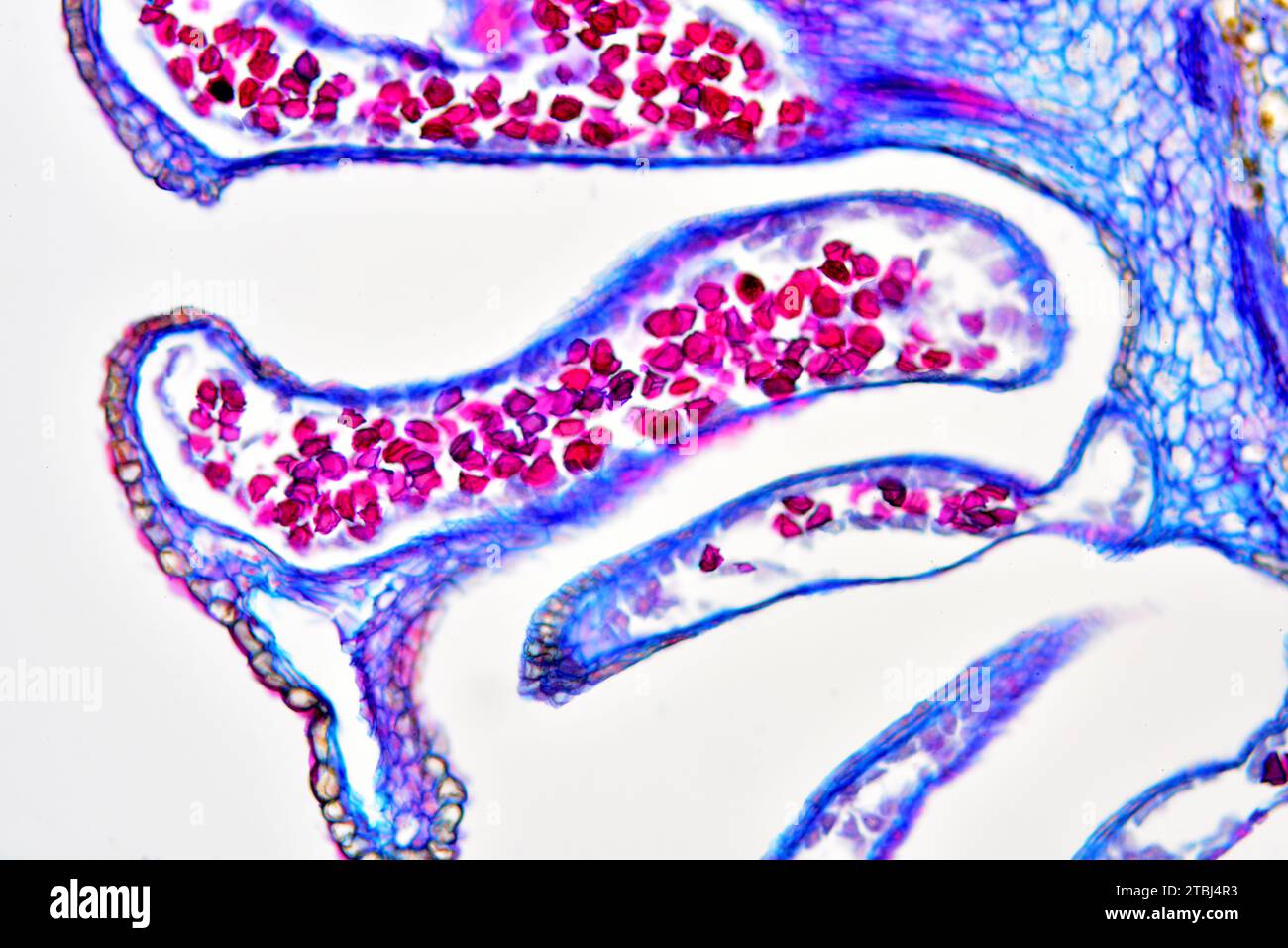 Microsporangia strobilus micrograph hi-res stock photography and images ...