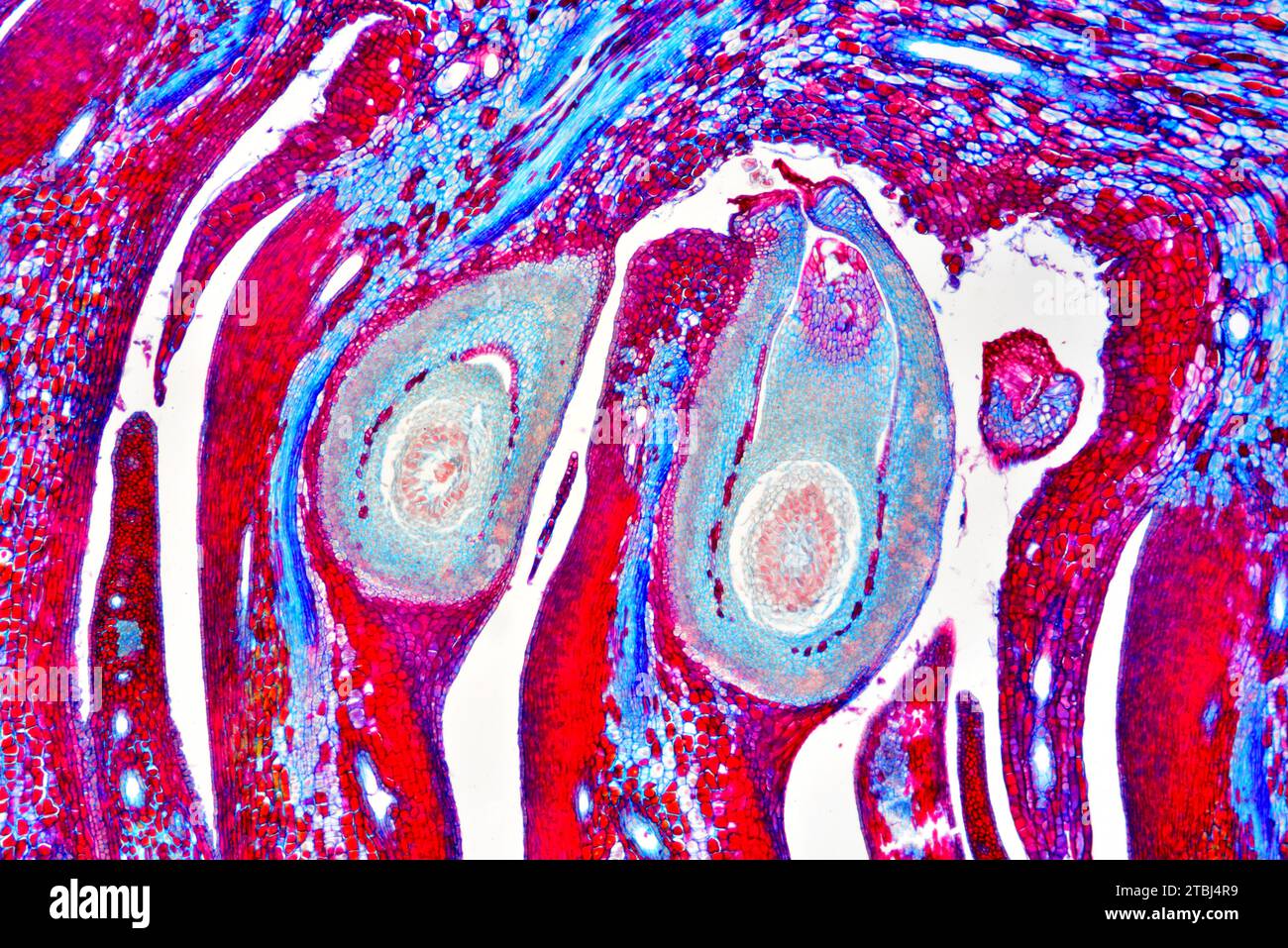 Female cone of pine (Pinus sp.) showing ovules. Optical microscope X40 ...