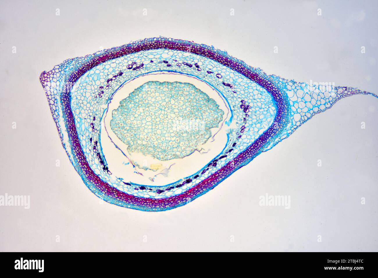 Female cone of pine (Pinus sp.) showing embryo and endosperm. Optical ...