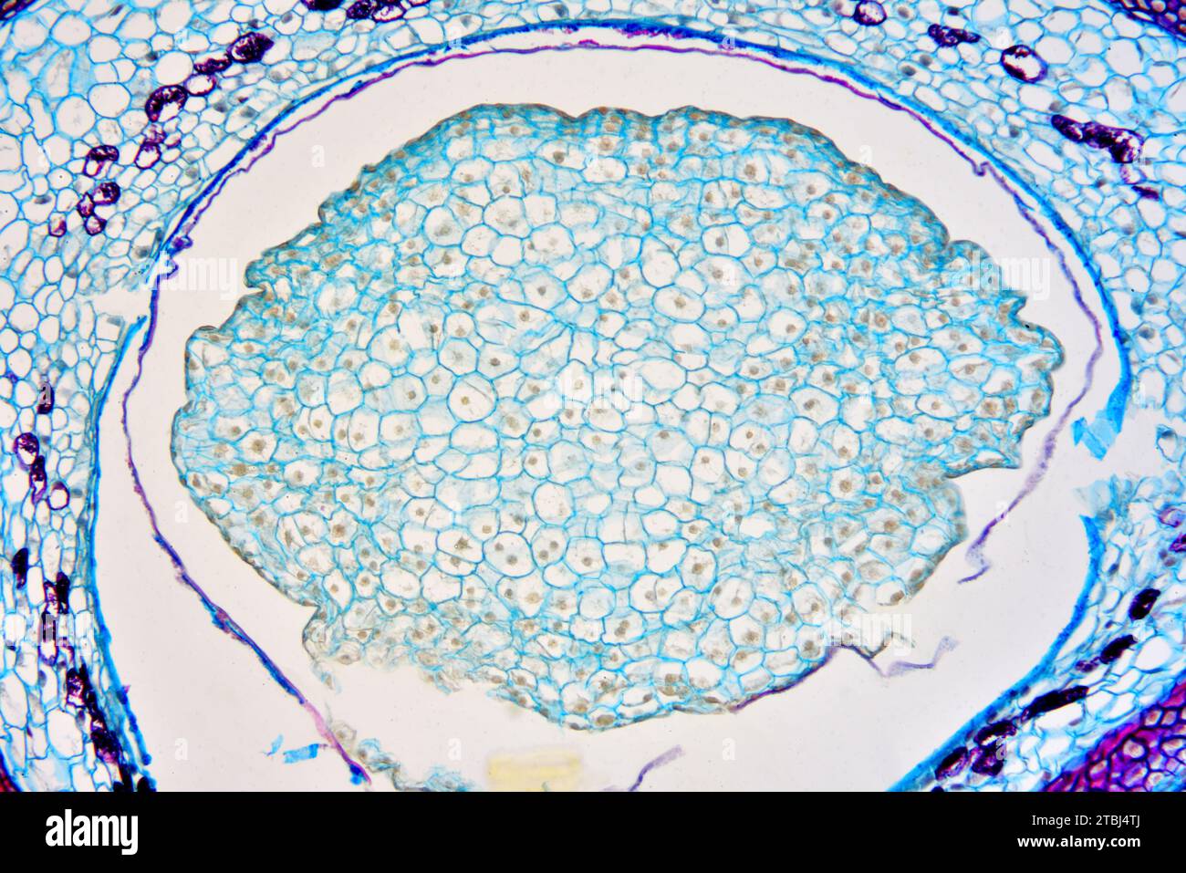 Female cone of pine (Pinus sp.) showing embryo and endosperm. Optical ...