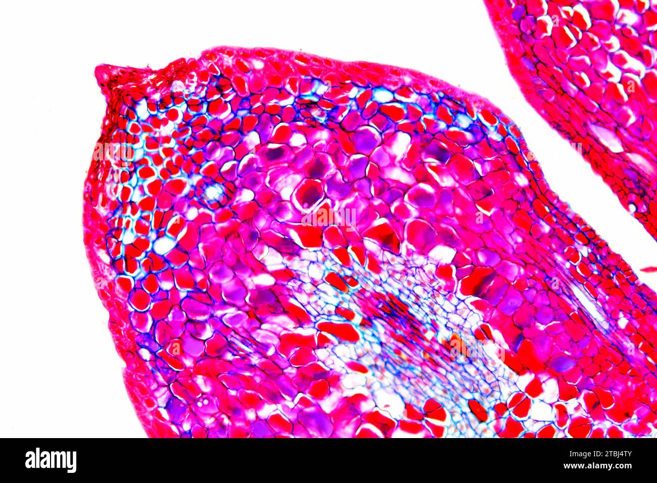 Female cone of pine (Pinus sp.) showing scale and sclerenchyma. Optical ...