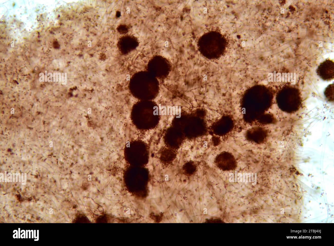 Conidia and conidiophores of fungus ascomycetes. Optical microcope X200 ...