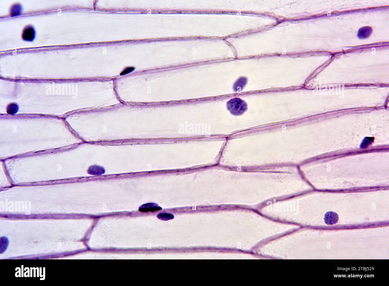 Onion epidermis (Allium cepa) showing cells and nucleus. Optical ...