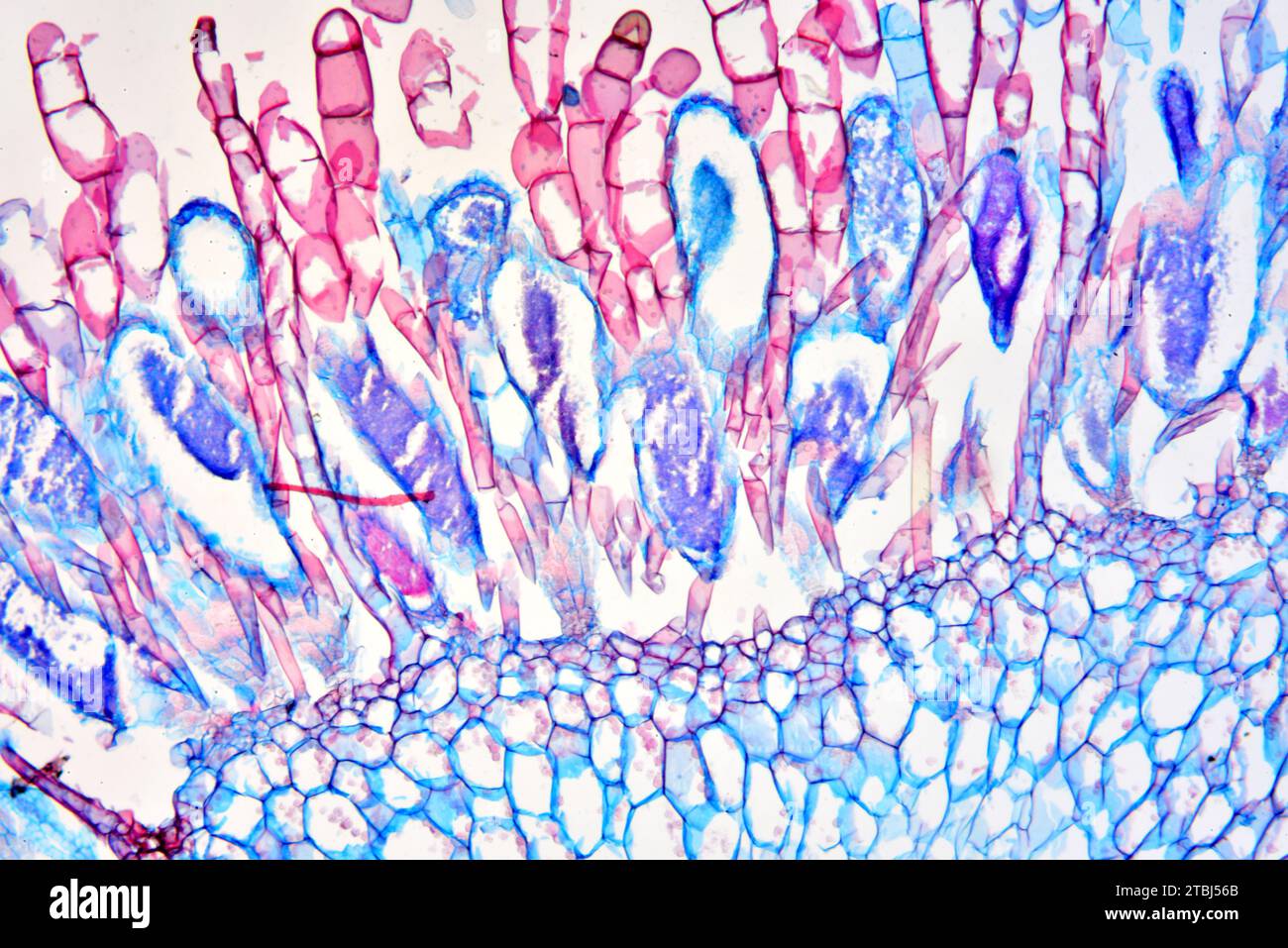 Antheridium of Mnium sp. Optical microscope X100 Stock Photo - Alamy