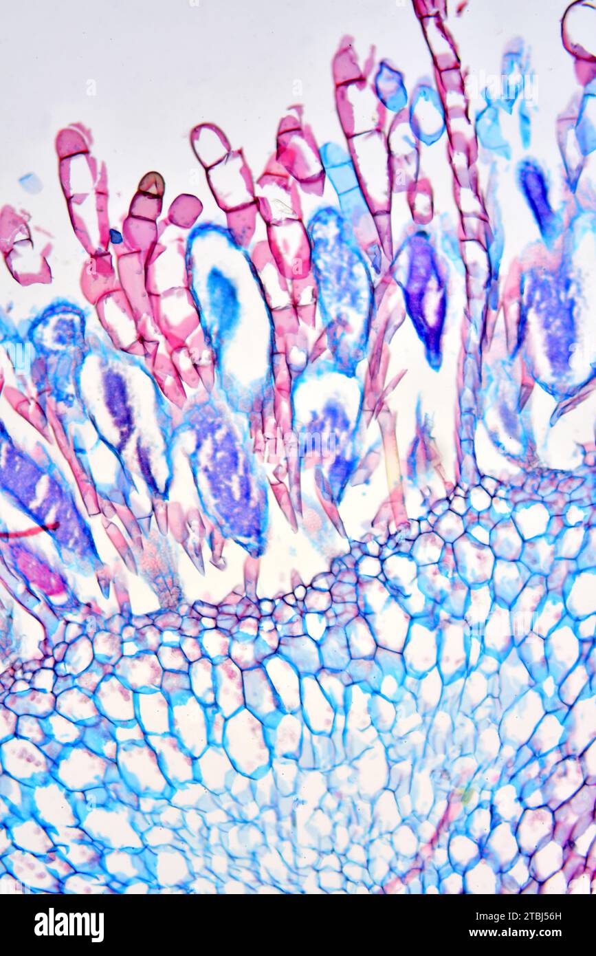 Antheridium of Mnium sp. Optical microscope X100 Stock Photo - Alamy