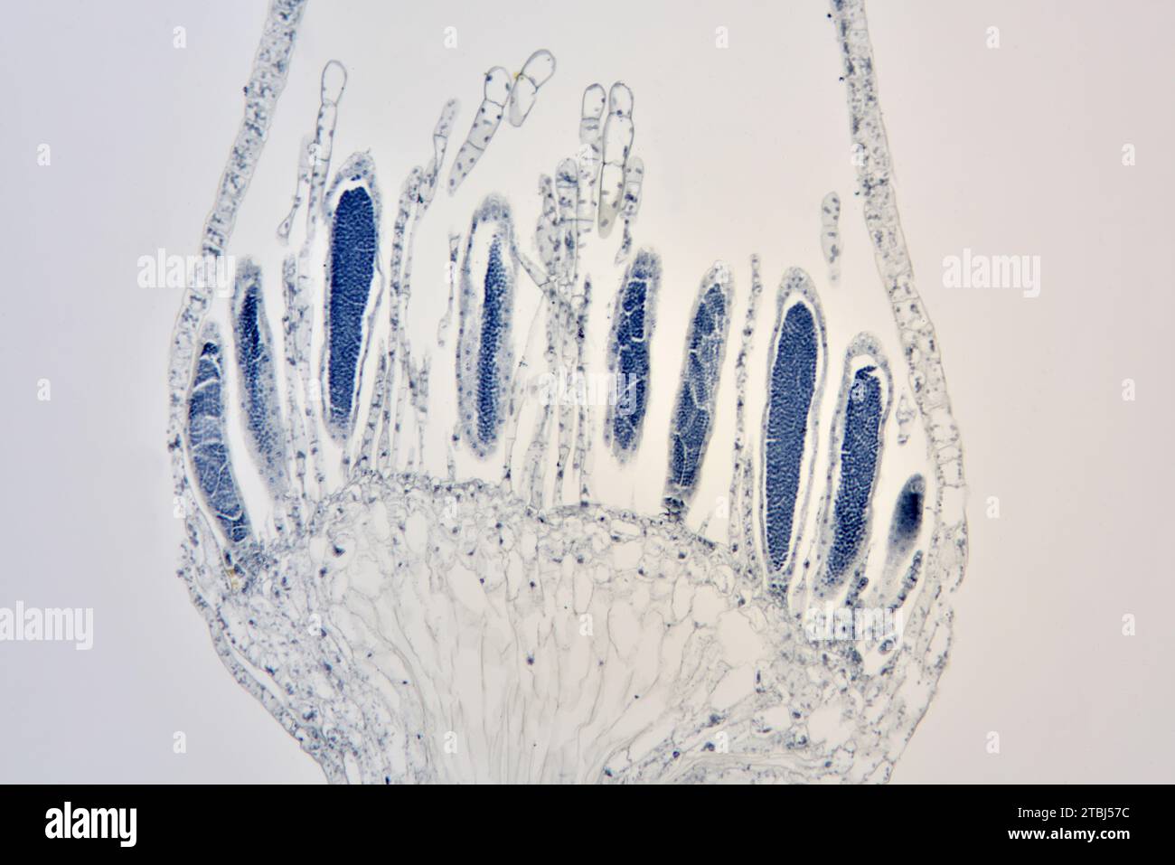 Moss microscope hi-res stock photography and images - Alamy