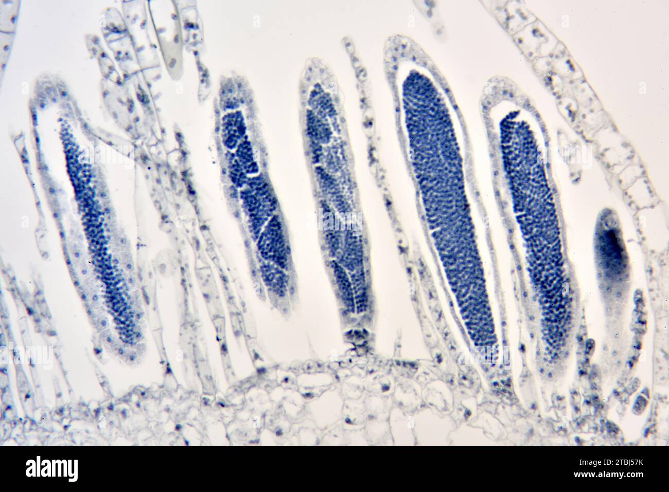 Antheridium of moss. Optical microscope X200 Stock Photo - Alamy