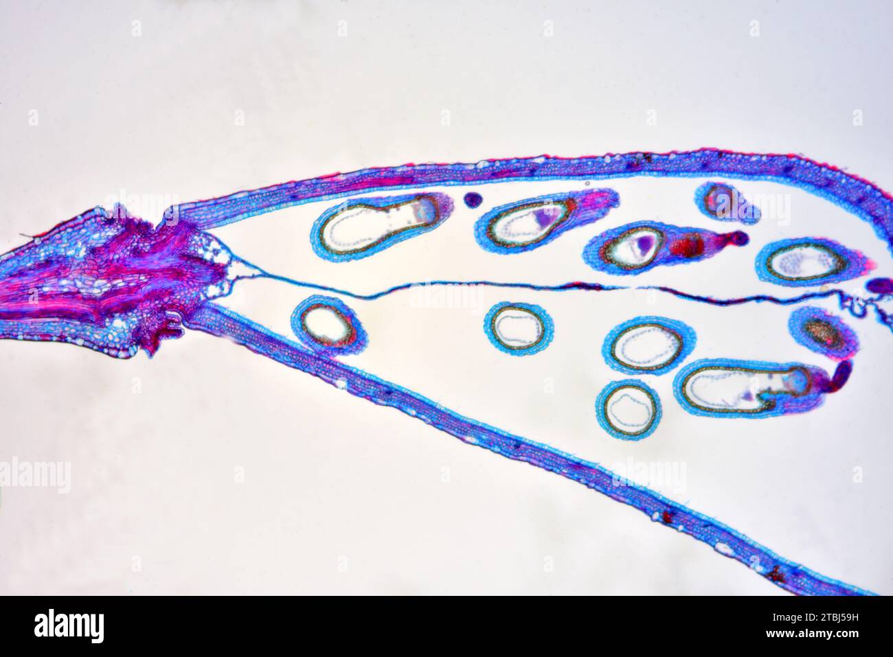 Ovary with embryos of shepherd purse (Capsella bursa-pastoris). Optical ...