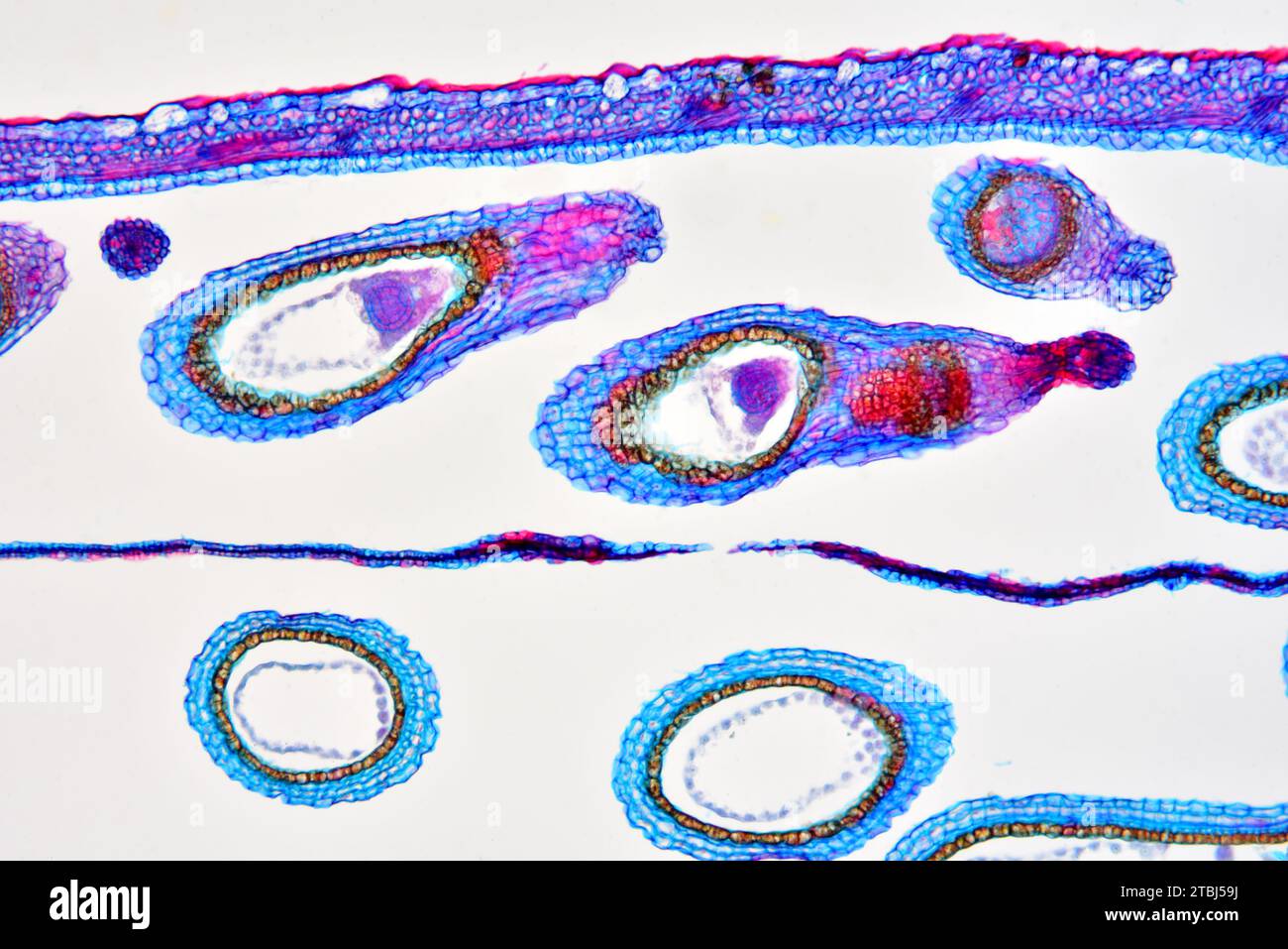 Ovary with embryos of shepherd purse (Capsella bursa-pastoris). Optical ...